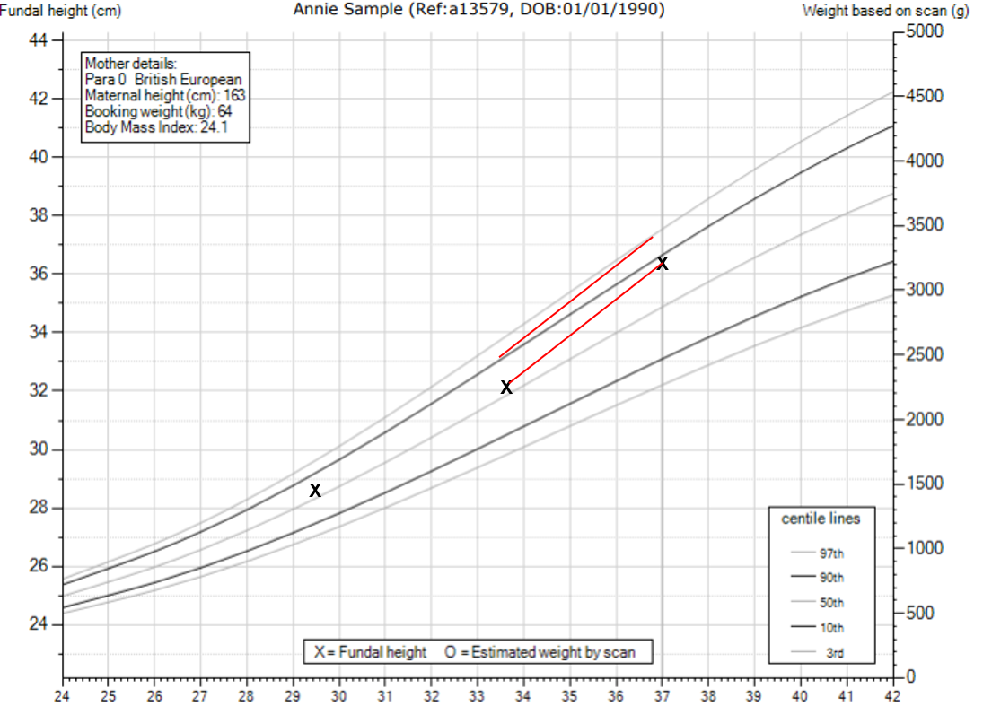 Perinatal Institute: Examples